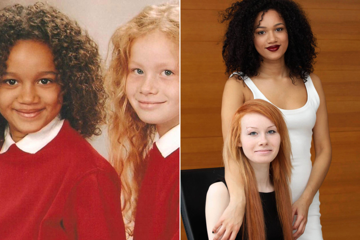 Biracial Twins Skin Color Is Not A Big Deal At All For These Twins