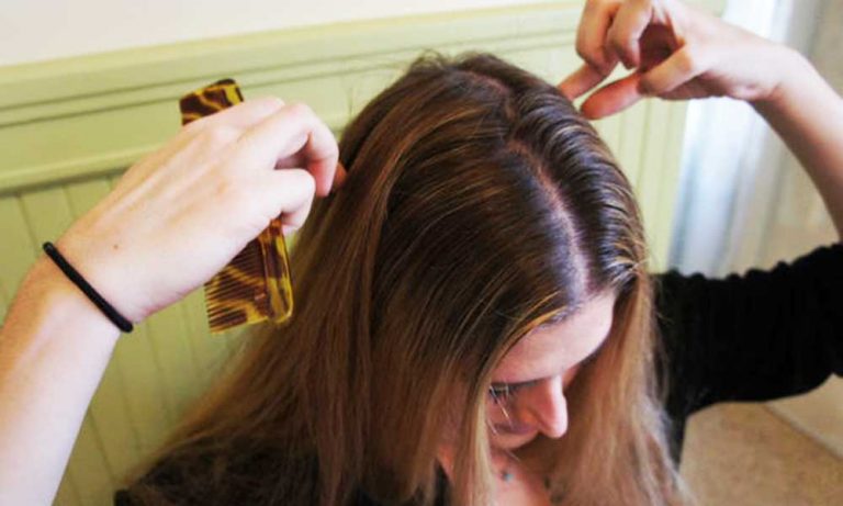 6 Remedies To Re-Grow Hair On The Crown Of Your Head!