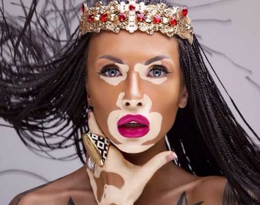 People With Unique Skin Color But Great Features Will Amaze You