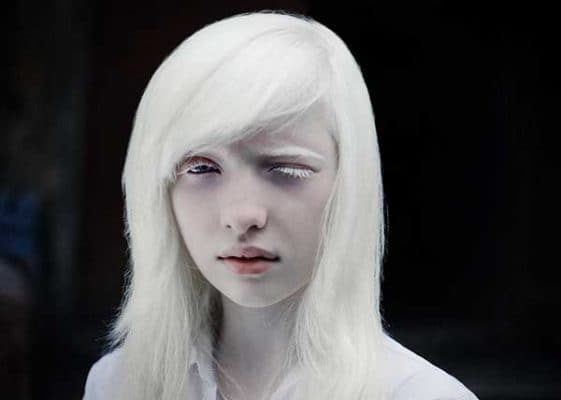 People With Unique Skin Color But Great Features Will Amaze You