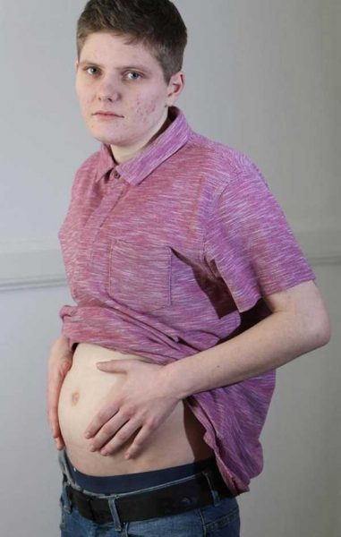 First pregnant man In History Gives Birth To A Baby Girl