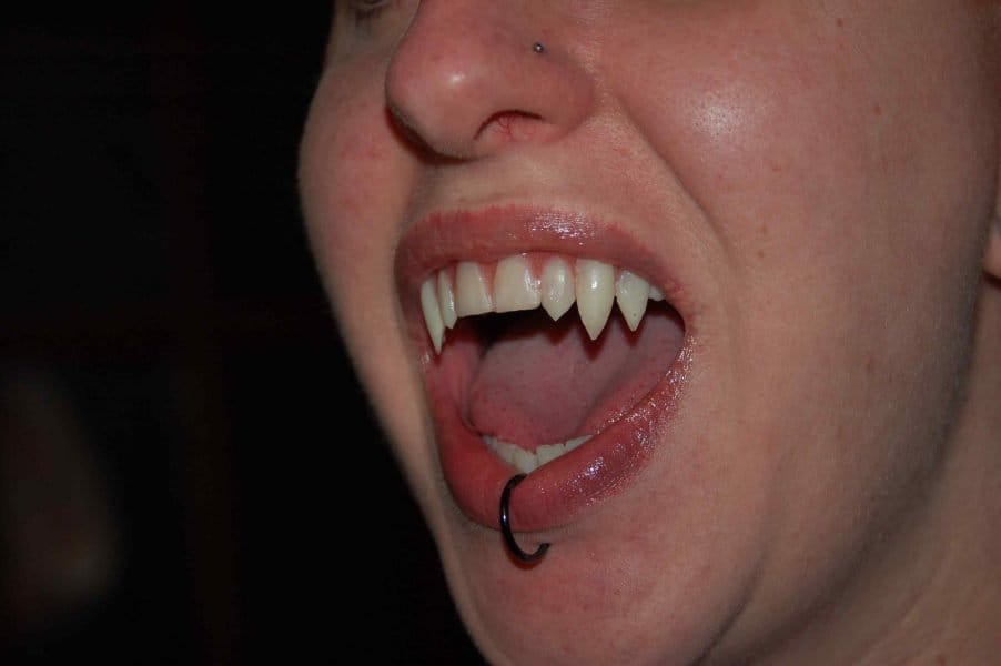 7 Weird Fashion Trends That You Just Can't Unsee!