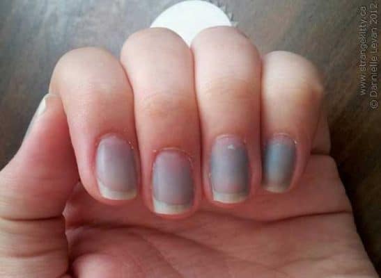 Nails That Tell Health Condition - Nails Indicate diseases